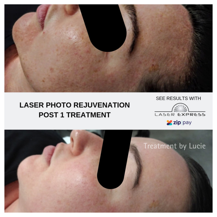 Before and After – Laser Express Services Pty Ltd